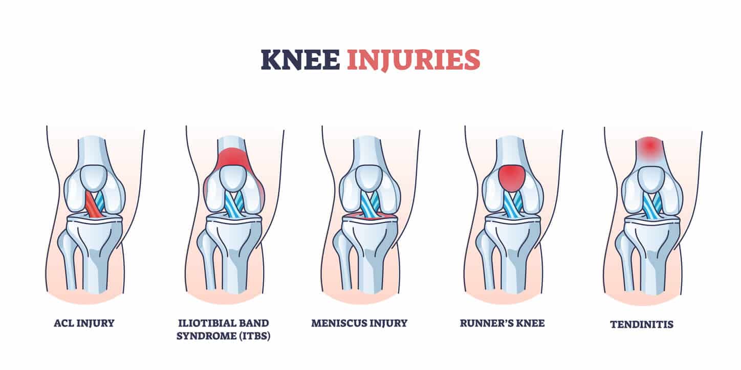 Common Sports and Activities Leading to Knee Tendonitis The Bone Joint Center