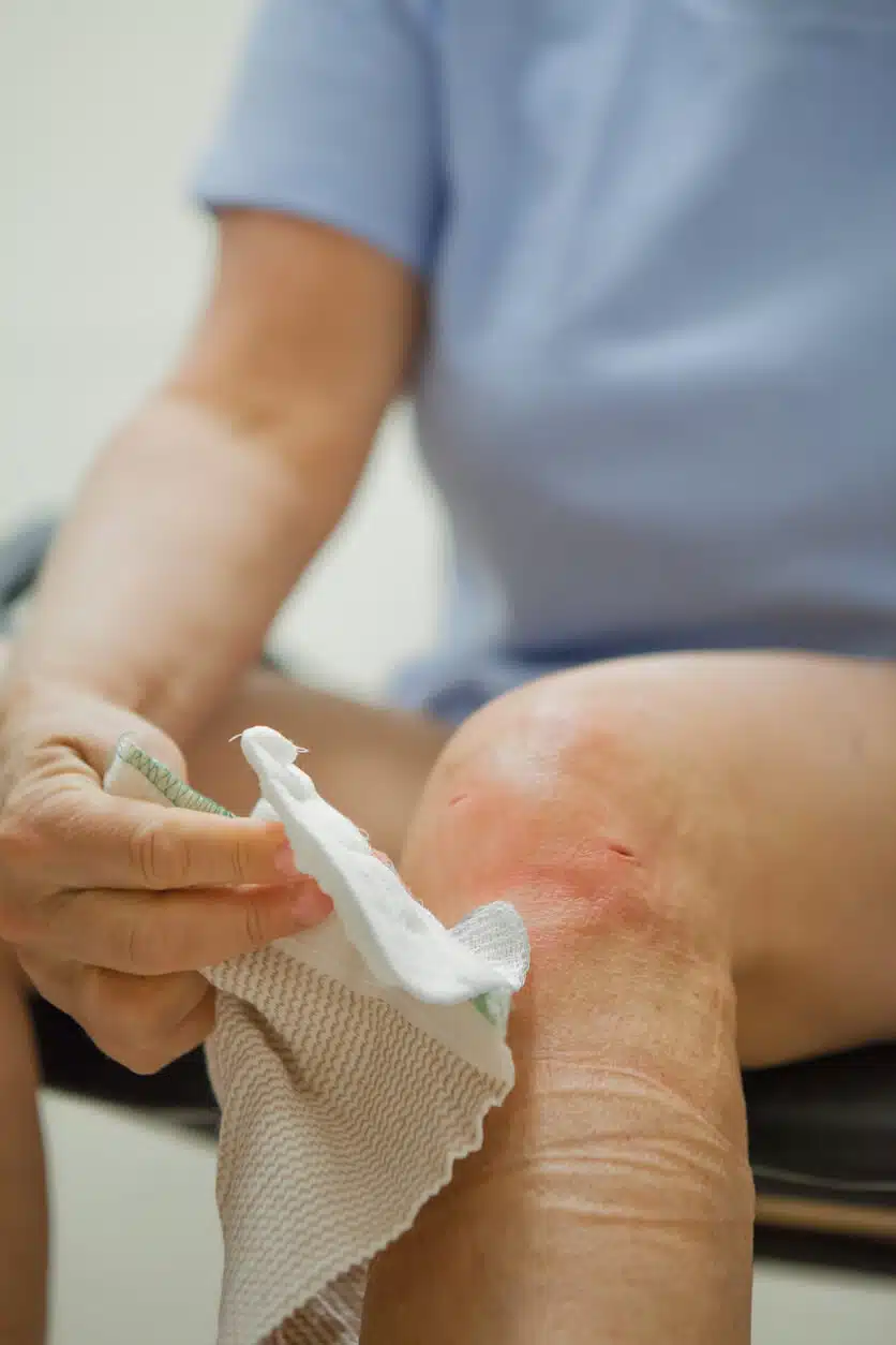 What to Expect Before Arthroscopic Knee Surgery: Preparation and ...