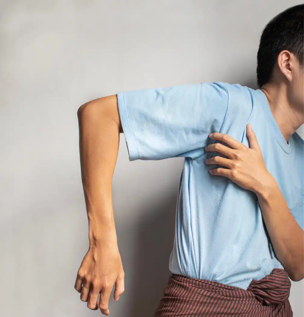 Frozen Shoulder Medical Treatment Explained | The Bone & Joint Center